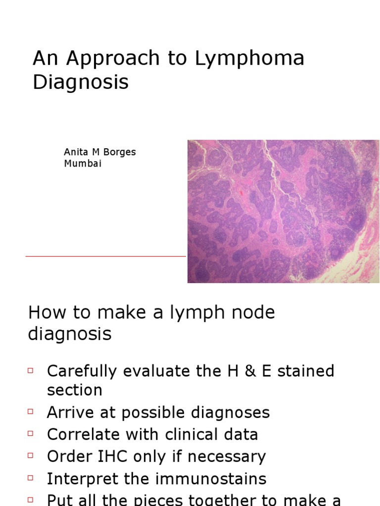 06 - Approach To Lymphoma Diagnosis | PDF | Lymphoma | Lymphatic System