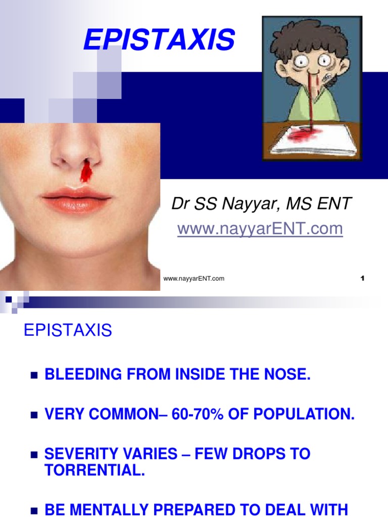 EPISTAXIS | PDF | Medical Specialties | Clinical Medicine