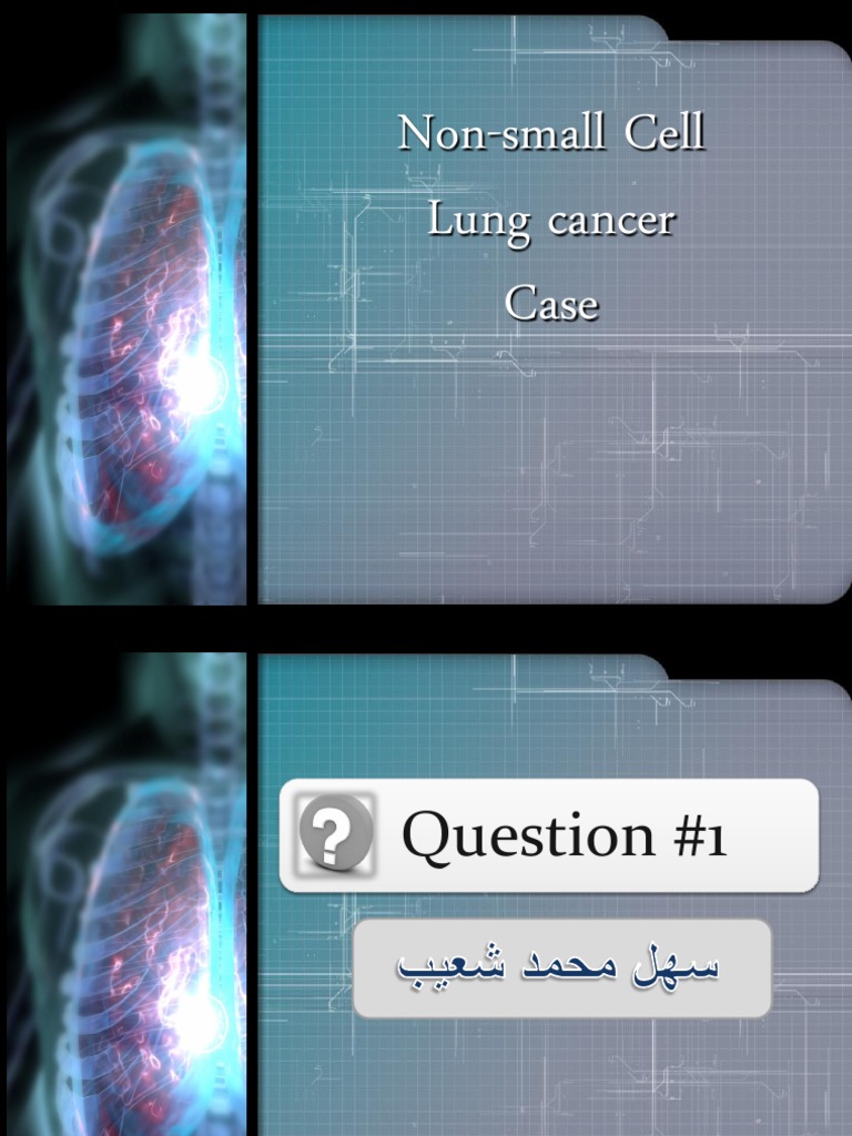 Lung Cancer Case Study | Non Small Cell Lung Carcinoma | Lung Cancer