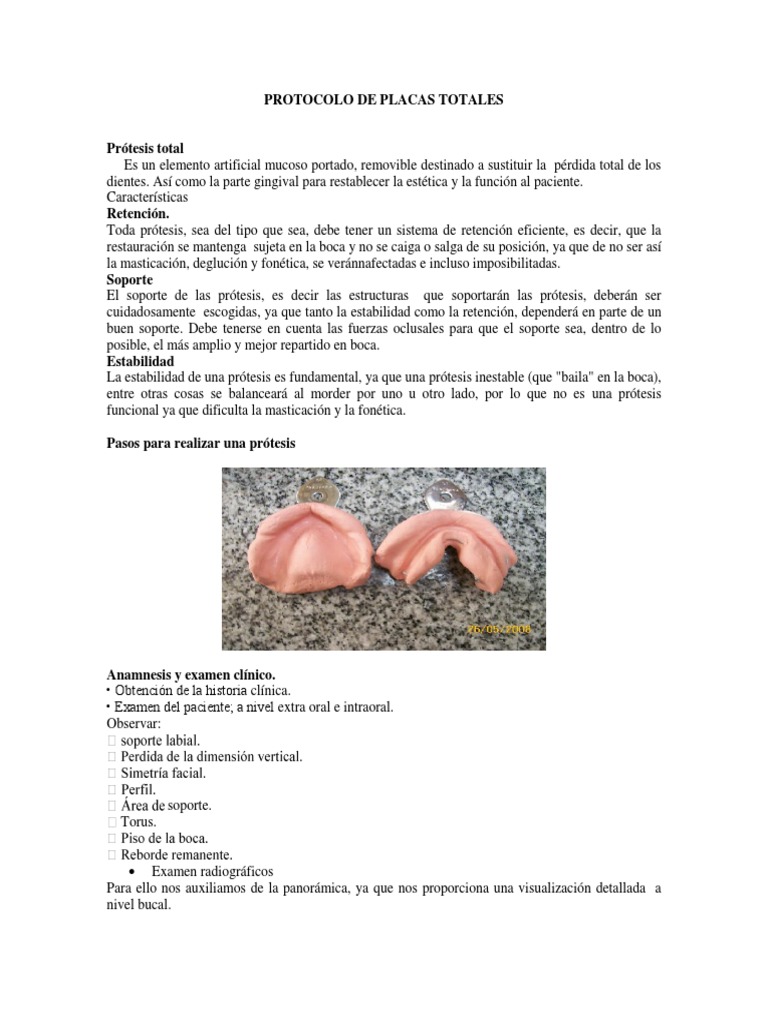 Protocolo para la confección de prótesis totales removibles | PDF ...