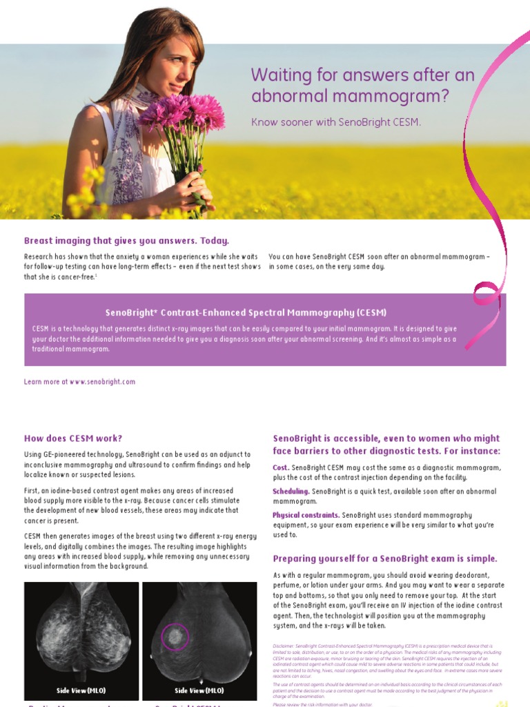 GEHealthcare Brochure Know Sooner With SenoBright | PDF | Mammography ...