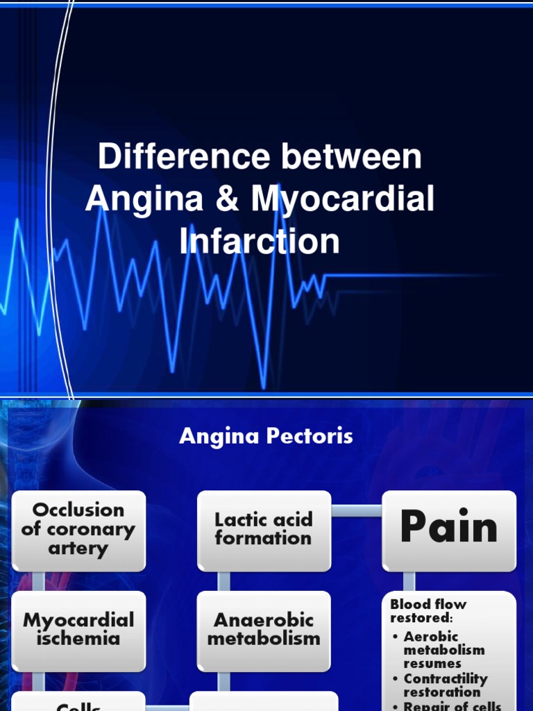 Difference Between Angina & Myocardial Infarction | PDF | Ischemia | Heart