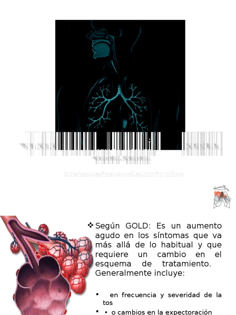 EPOC Exacerbado | Enfermedad pulmonar obstructiva crónica | Tos
