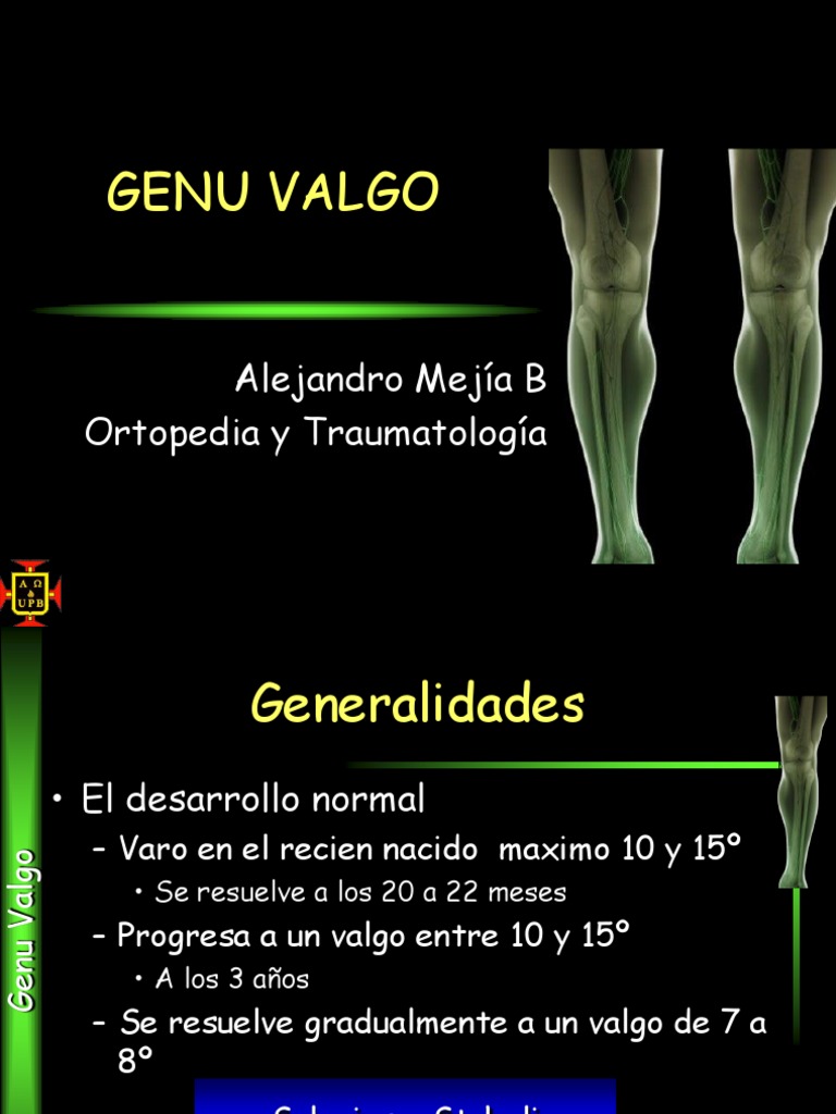 Genu Valgo 2 | PDF | Rodilla | Medicina