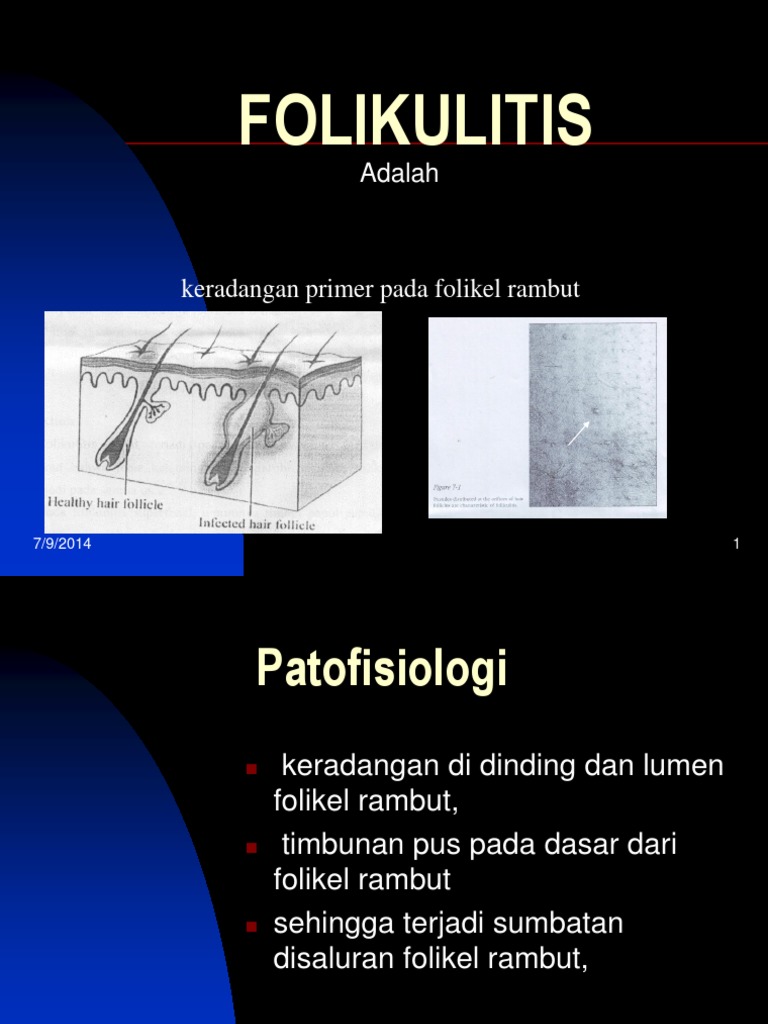 FOLIKULITIS | PDF