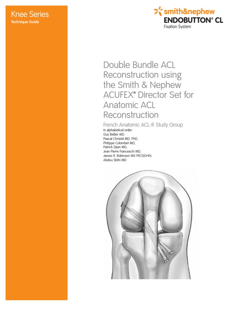 Double Bundle ACL Reconstruction Using The Smith & Nephew ACUFEX ...
