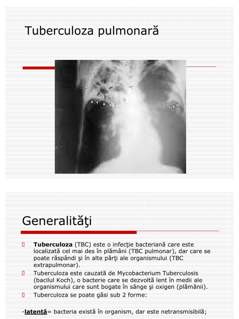 Tuberculoza Pulmonară | PDF