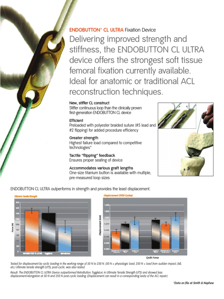 Endobutton Ultra | Fixation (Histology) | Surgery