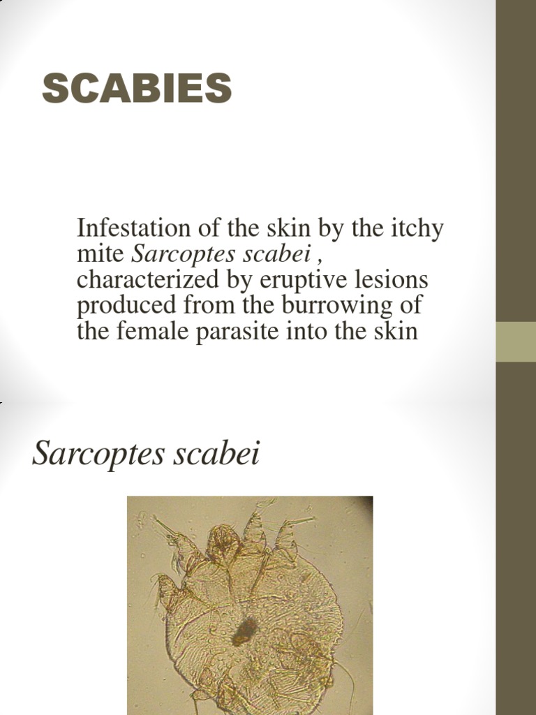 Scabies Presentation | PDF | Clinical Medicine | Medical Specialties