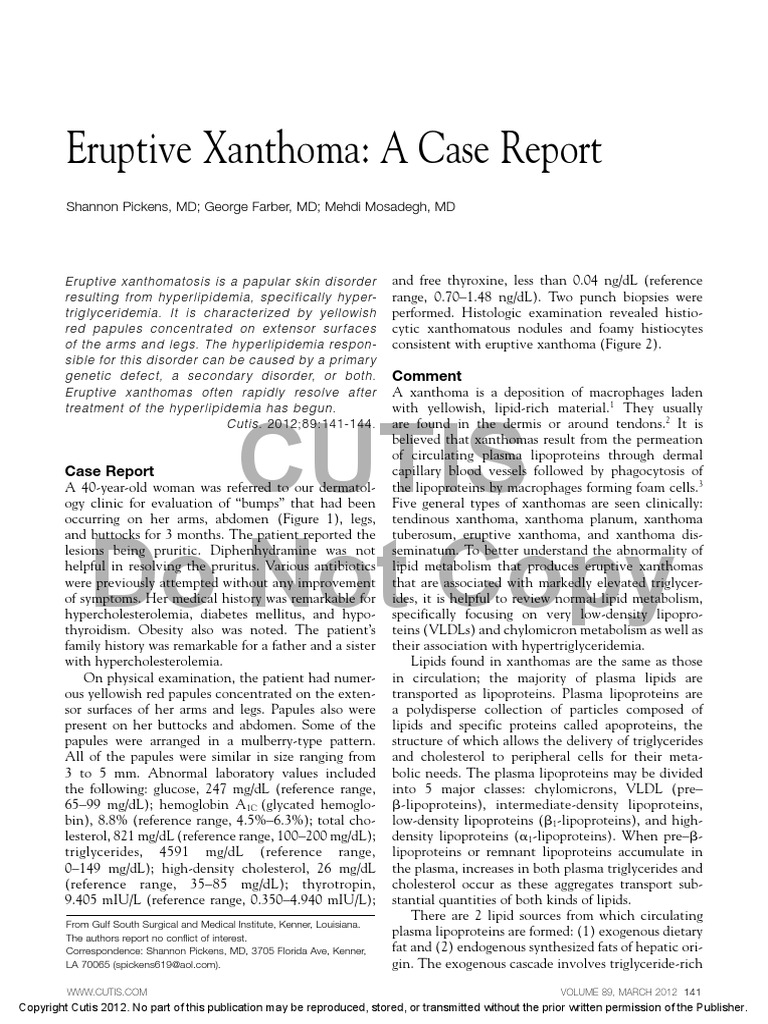 Eruptive Xanthoma: A Case Report: Cutis Do Not | PDF | Lipoprotein ...