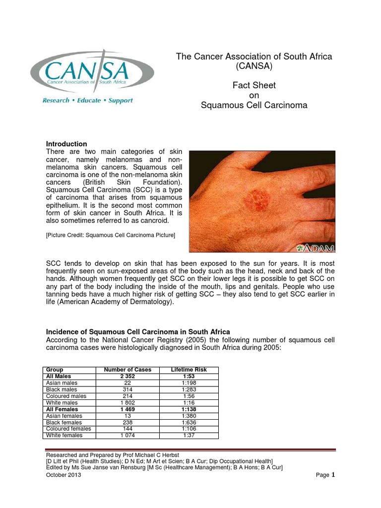 Fact Sheet Squamous Cell Carcinoma Oct 2013 | Skin Cancer | Clinical Trial