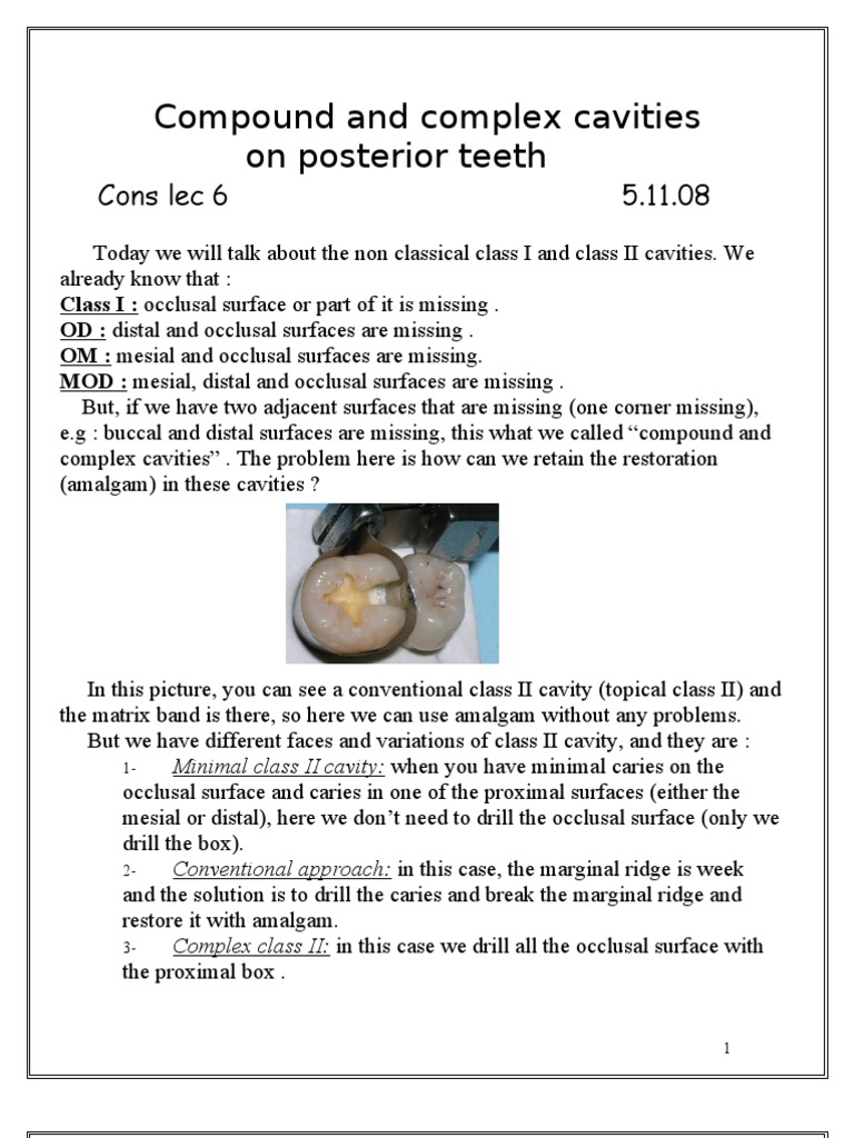 Compound and Complex Cavities On Posterior Teeth: Cons Lec 6 5.11.08 ...