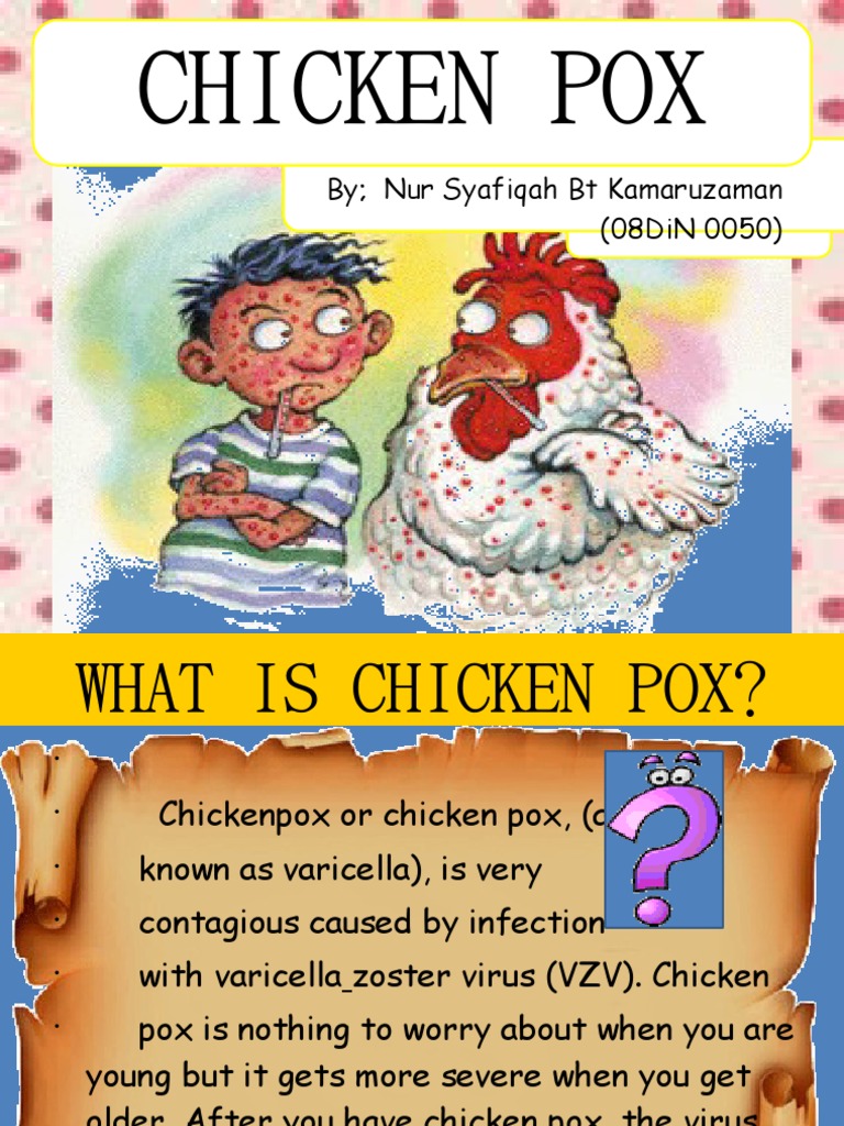 chicken pox presentation | Animal Virology | Virology