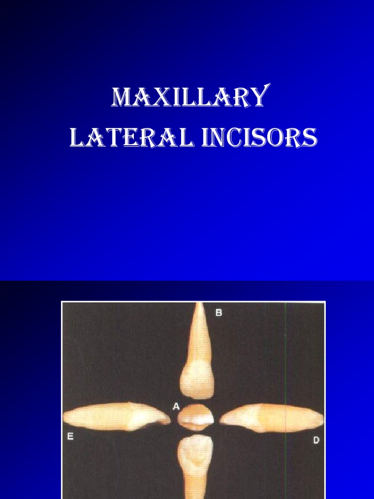 Maxillary & Mandibular Lateral Incisor | Download Free PDF | Facial ...