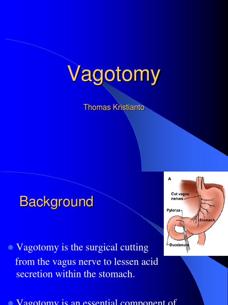 Truncal Vagotomy Open