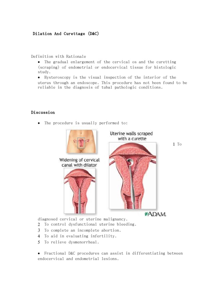 DNC 2 | PDF | Gynaecology | Women's Health