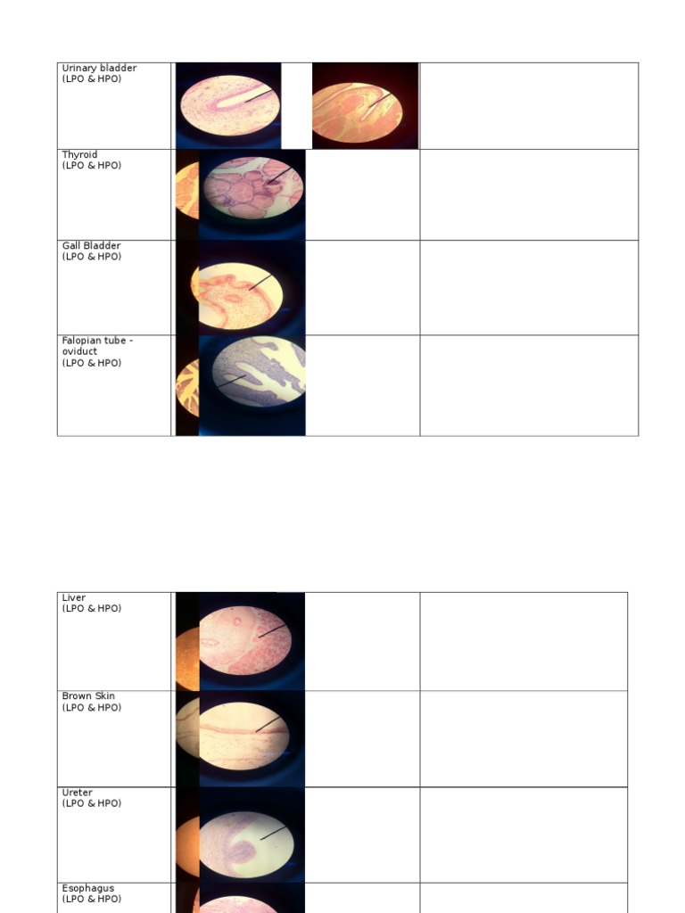Urinary Bladder (Lpo & Hpo) | PDF