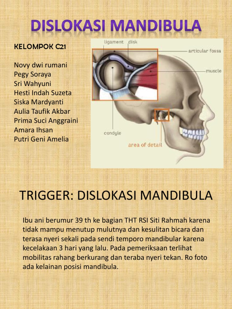 Dislokasi Mandibula | PDF