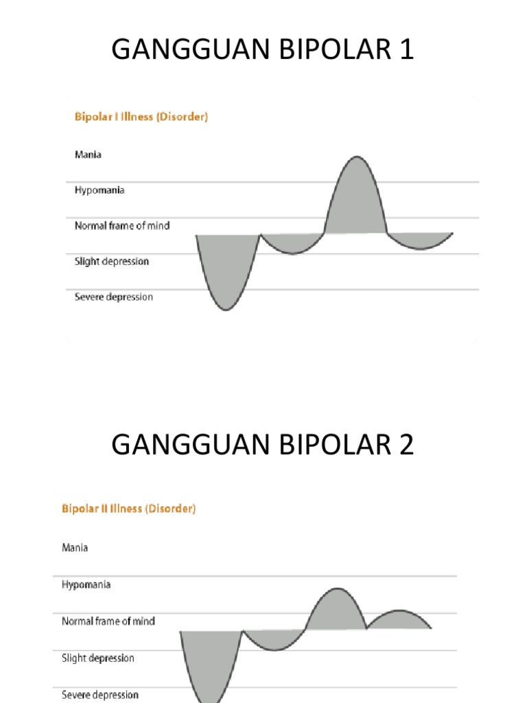 Bipolar Mixed Episode Overview | PDF