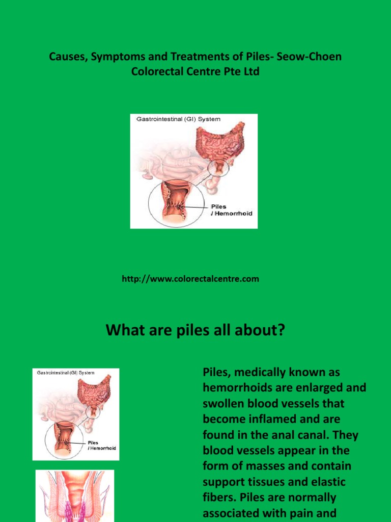 Causes, Symptoms and Treatments of Piles - Seow-Choen Colorectal Centre ...
