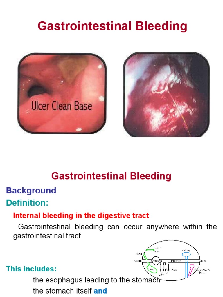 Gastrointestinal Bleeding | PDF | Gastrointestinal Tract | Digestive System