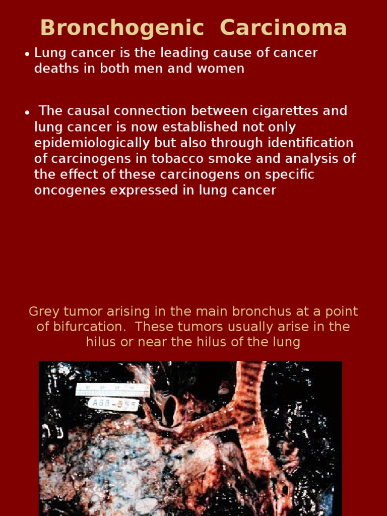 11. Bronchogenic Carcinoma | Non Small Cell Lung Carcinoma | Lung Cancer