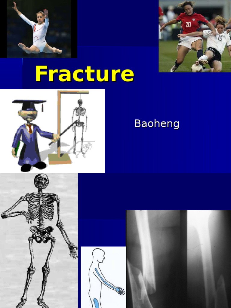 Fracture 01 | PDF | Fracture | Bone