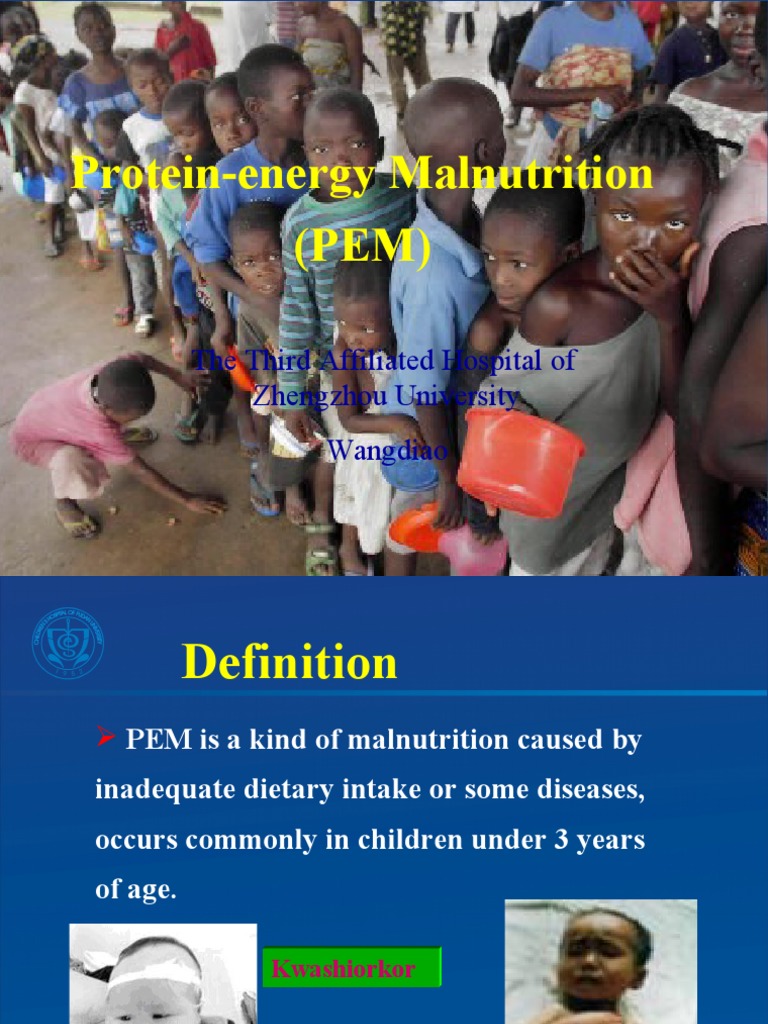 Pem 2007 | PDF | Malnutrition | Nutrition