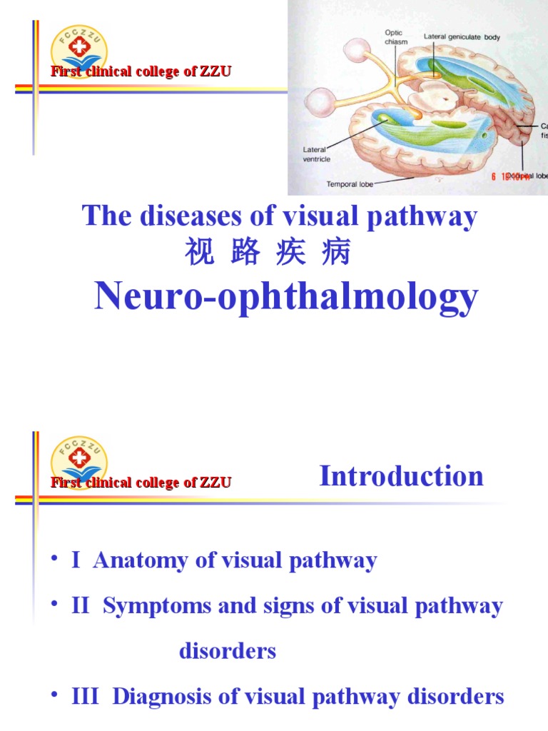 The Diseases of Visual Pathway: Neuro-Ophthalmology | PDF | Visual ...