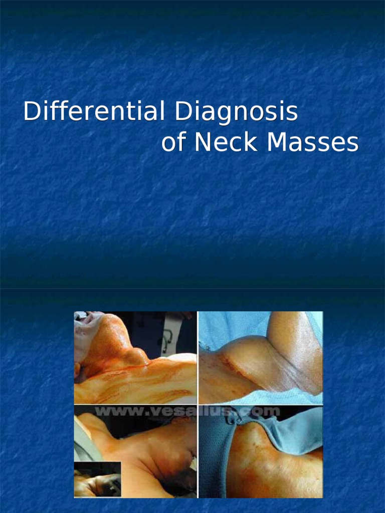 Differential Diagnosis of Neck Masses | PDF | Metastasis | Neck