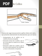Mano de Predicador | PDF | Mano | Anatomía humana