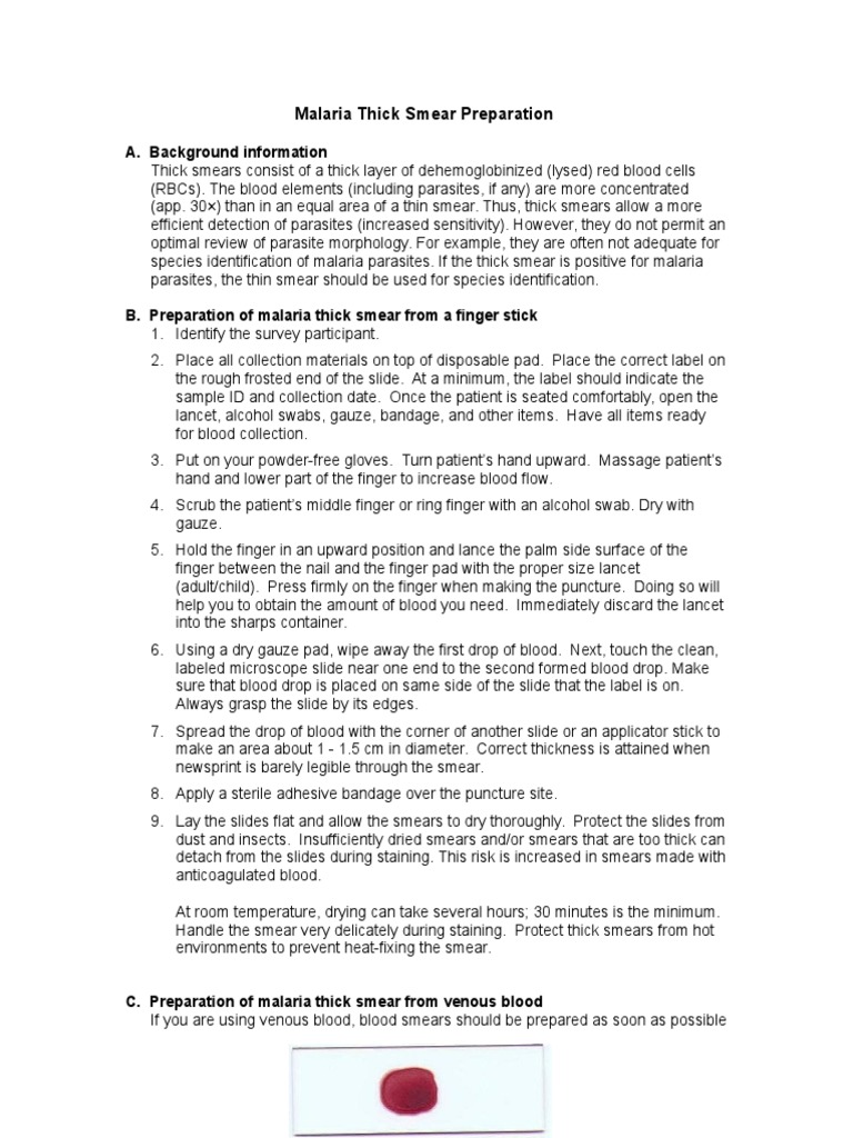 Malaria Thick Smear Preparation Guide | PDF | Medical Specialties | Blood