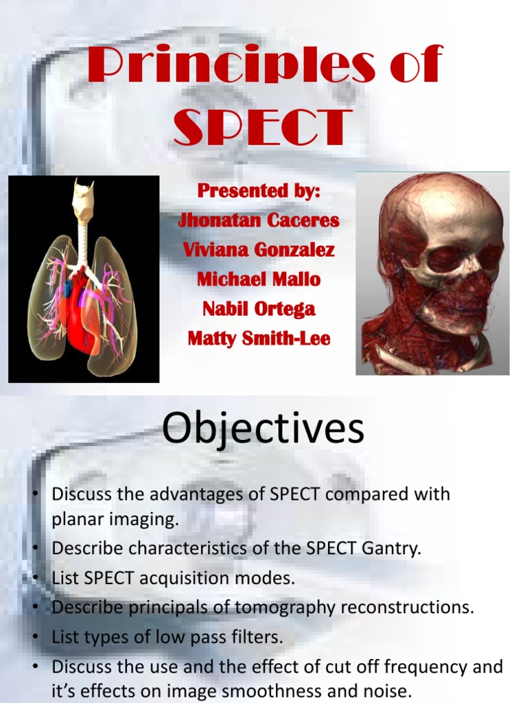 Principles of Spect | PDF | Ct Scan | Medical Imaging