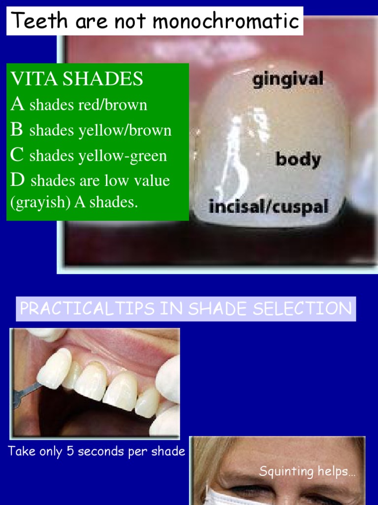 Class IV Restorations | Dental Composite | Dentistry Branches