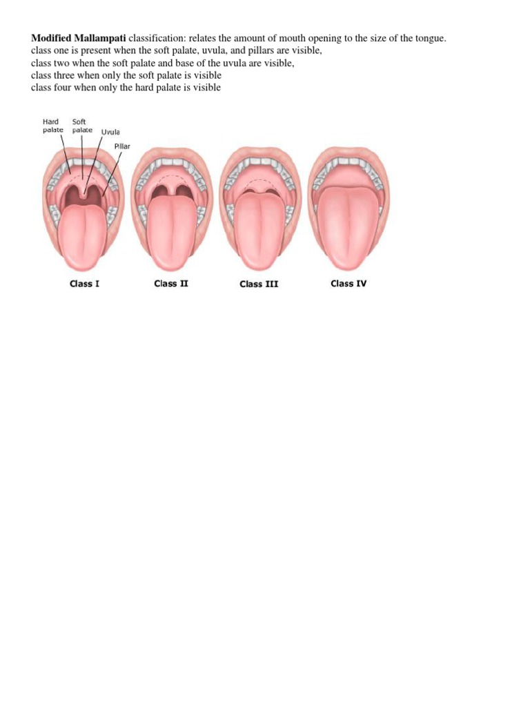 Modified Mallampati Classification | PDF