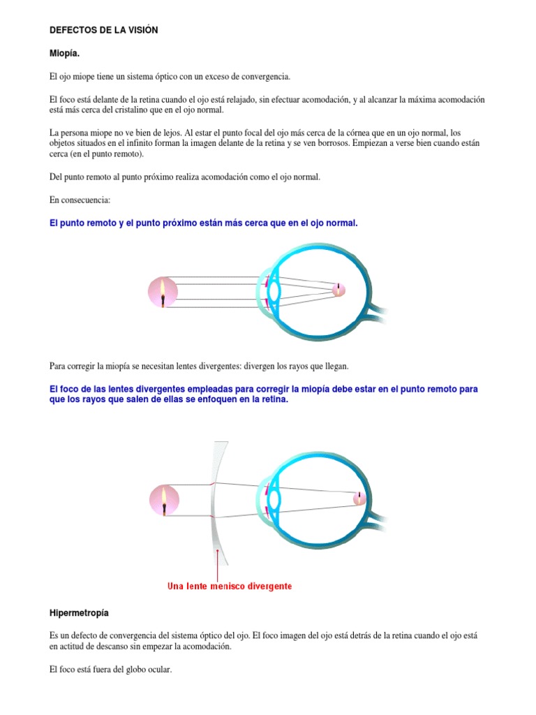 Defectos Comunes de la Visión | PDF | Ojo humano | Percepción visual