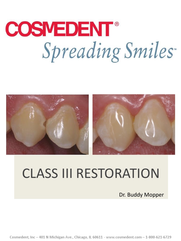 Class III Dental Restoration Guide | PDF