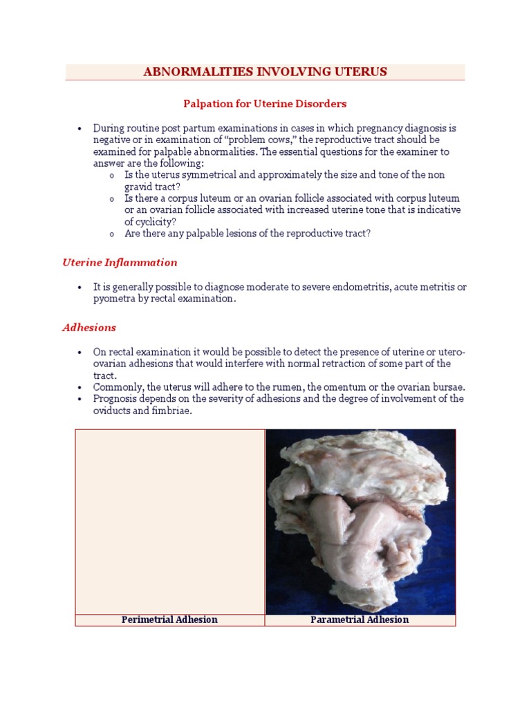 Abnormalities Involving Uterus Pdf Ovarian Cancer Ovary