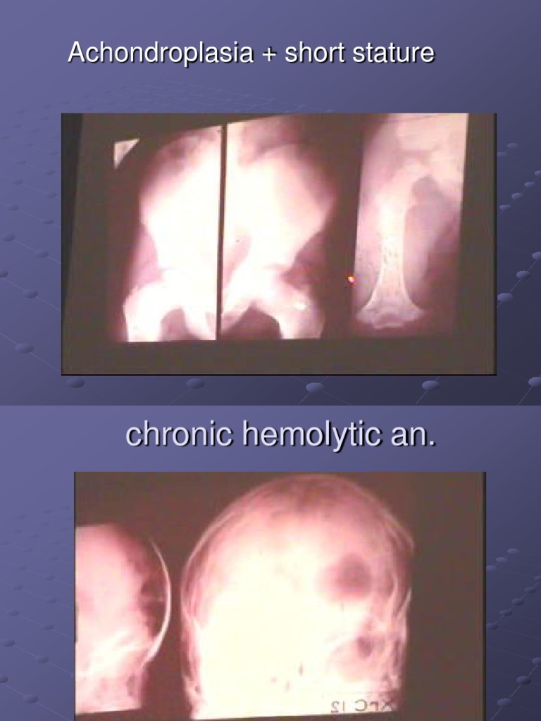 X Ray Pediatrics | PDF