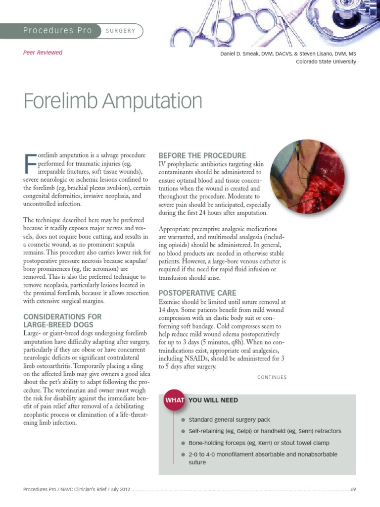 Step by Step Amputation | Amputation | Surgery