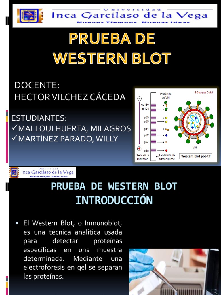 Western Blot Expos | PDF | Anticuerpo | Bioquímica