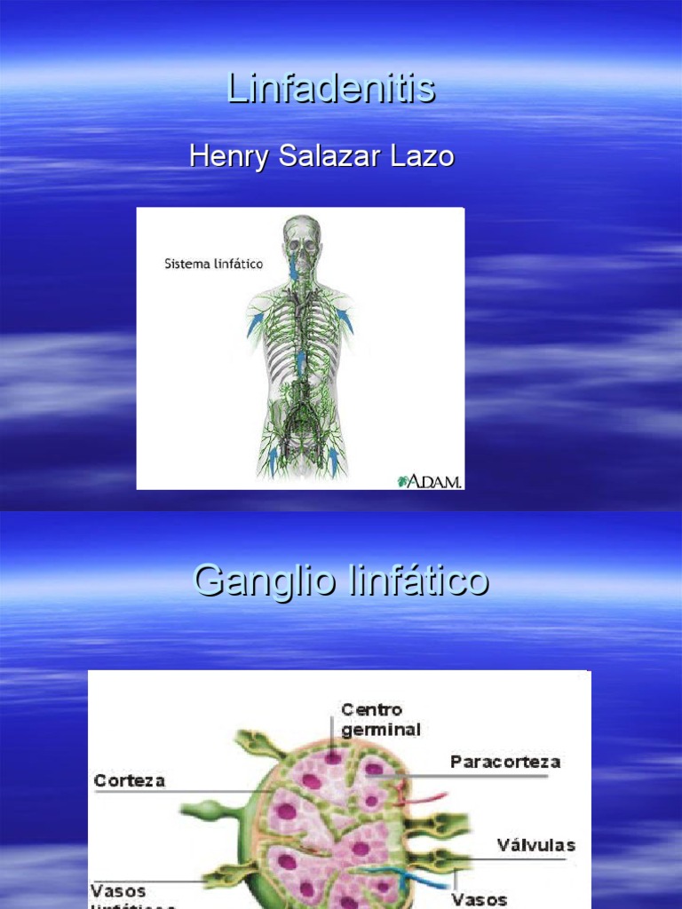 linfadenitis | Ganglio linfático | Biología celular