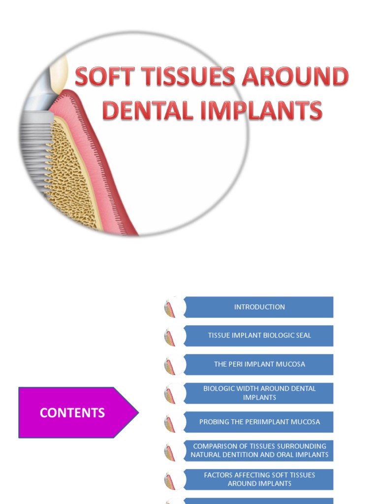 Peri-Implant Mucosa and Biological Seal | PDF | Dental Implant | Anatomy