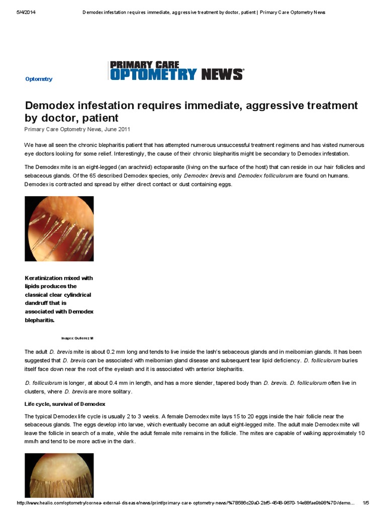Demodex Infestation Requires Immediate, Aggressive Treatment by Doctor ...