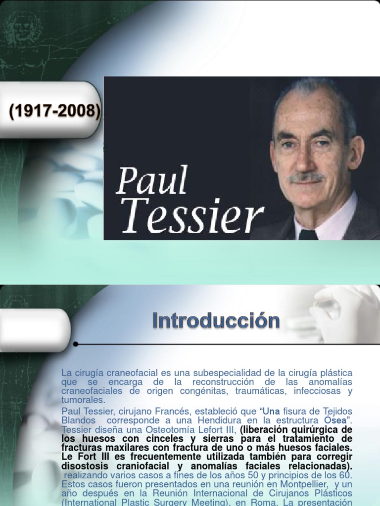 Clasificación de Hendiduras de Tessier | PDF | Especialidades Medicas ...