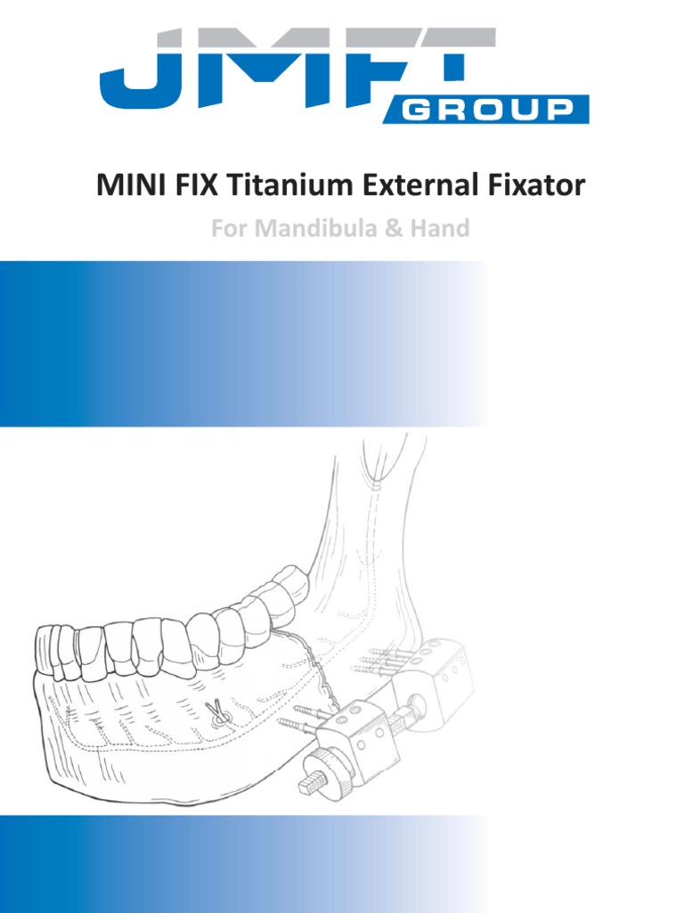MINI FIX Titanium External Fixator | PDF | Surgery | Diseases And Disorders