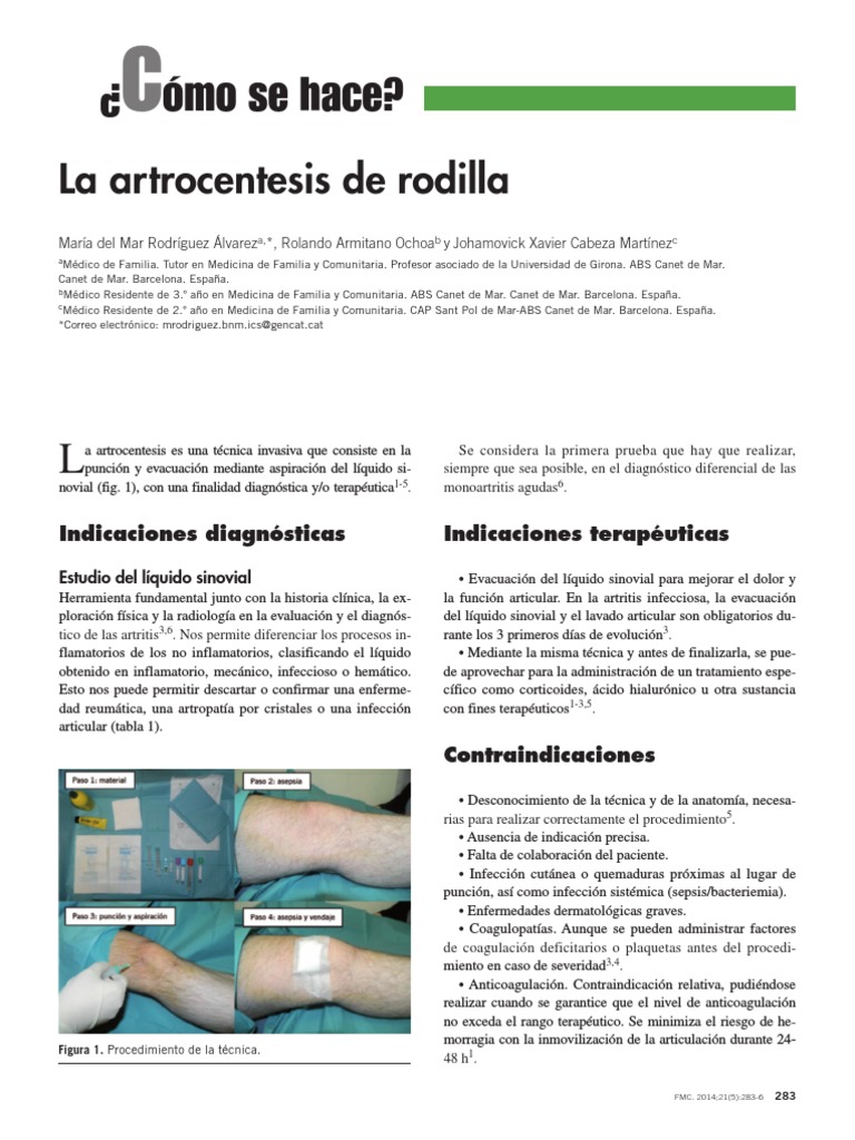 Técnica de Artrocentesis de Rodilla | PDF | Rodilla | Inflamación
