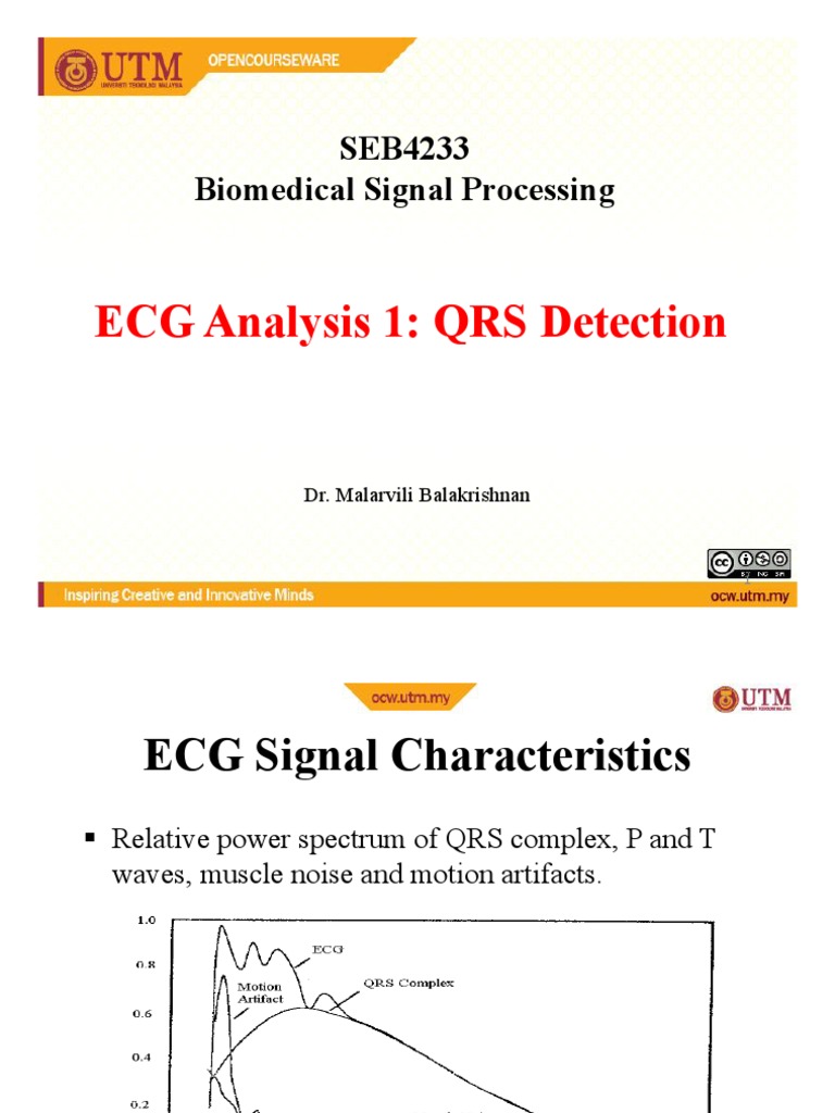 Analysis Of A Qrs Detection Algorithm For Ecg Signals Pdf Filter