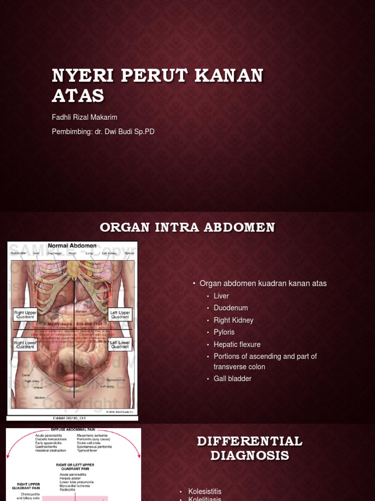 Nyeri Perut Kanan Atas | PDF
