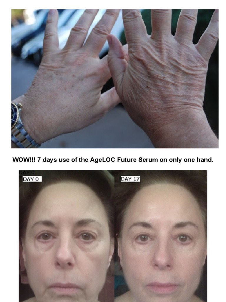 AgeLOC Testimonials | PDF